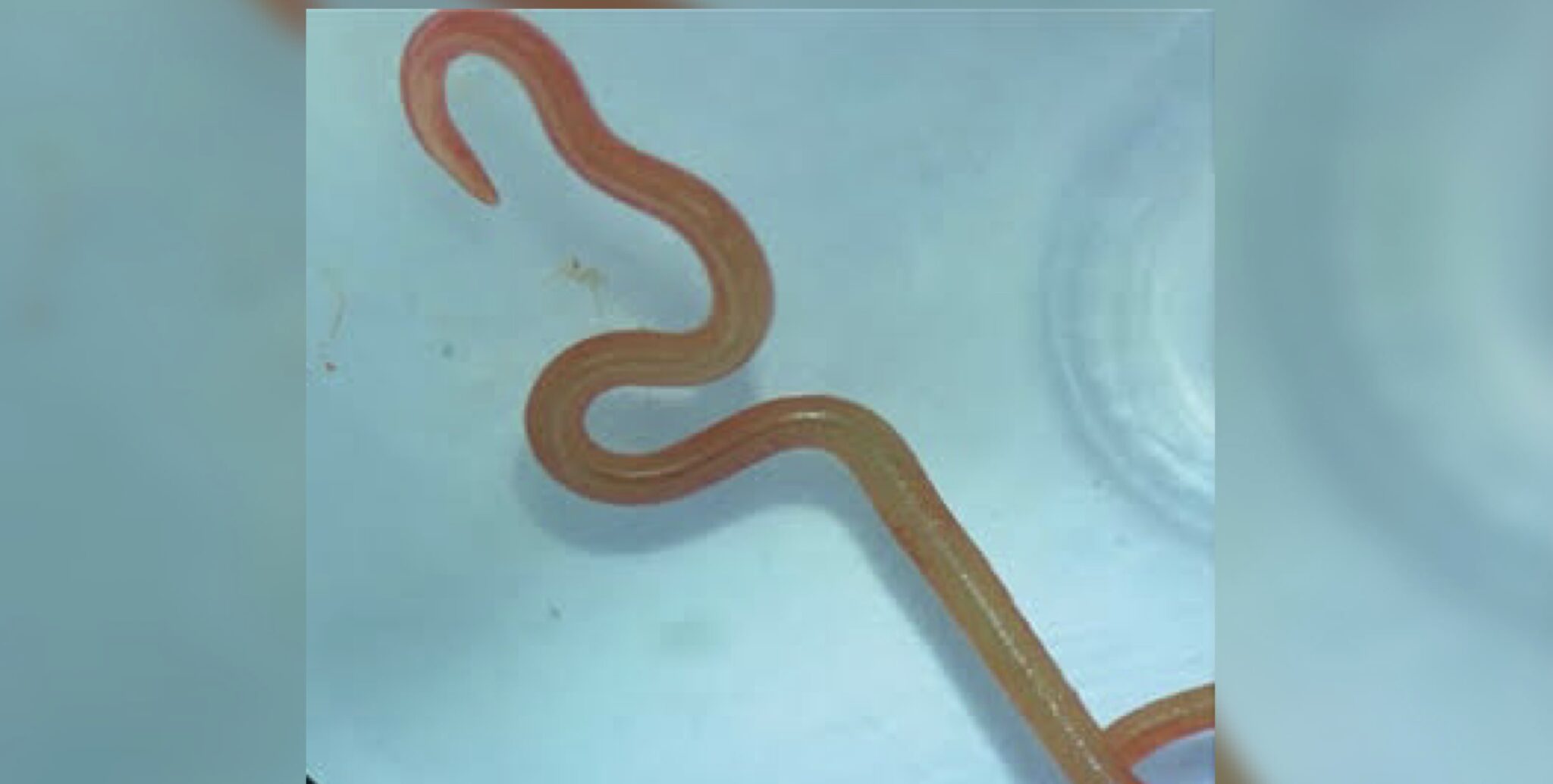 Live parasitic worm found in Australian woman's brain in world's first ...